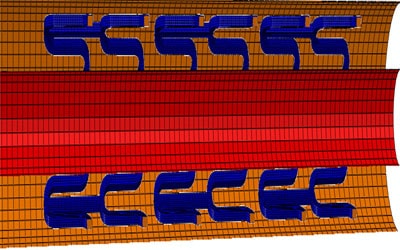 Finite Element Analysis (FEA) of a Coronary Stent - Finite Element ...